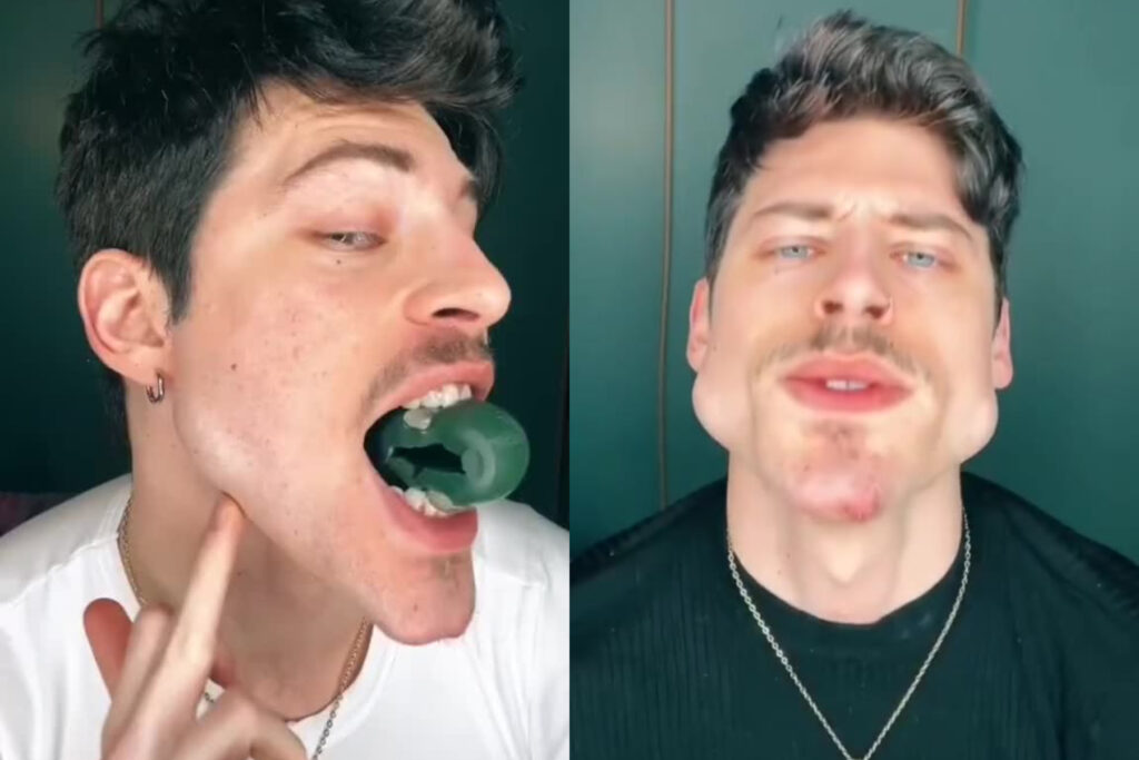 Mandíbula marcada: una perillosa tendència viral a Tiktok